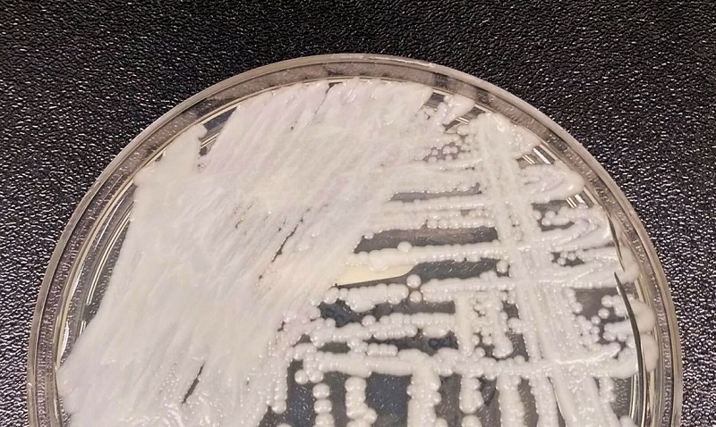 Anvisa confirma novo caso do superfungo Candida auris - Diário do Poder